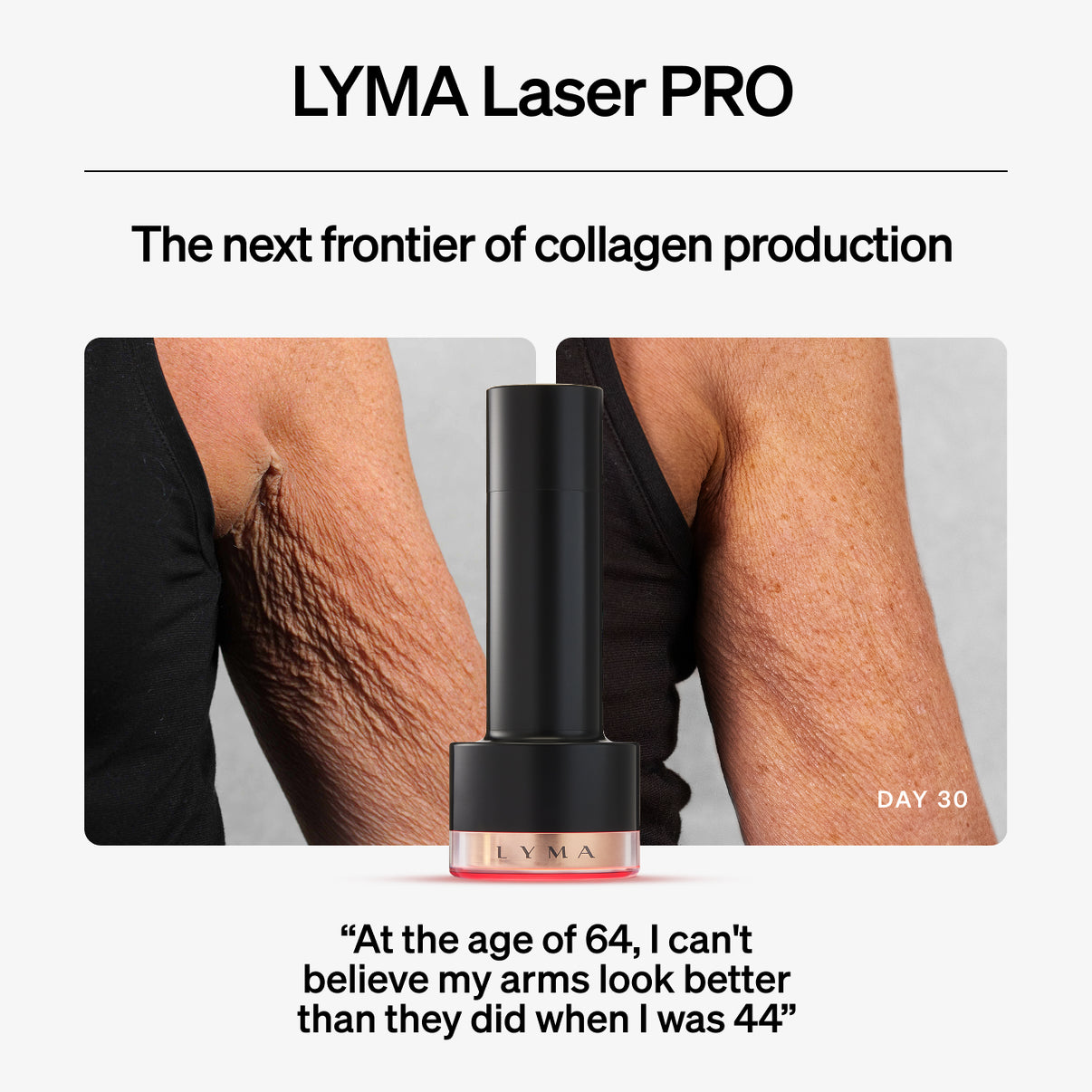 LYMA Laser PRO: The Ultimate At-Home Cosmetic Laser for Face, Neck & Body