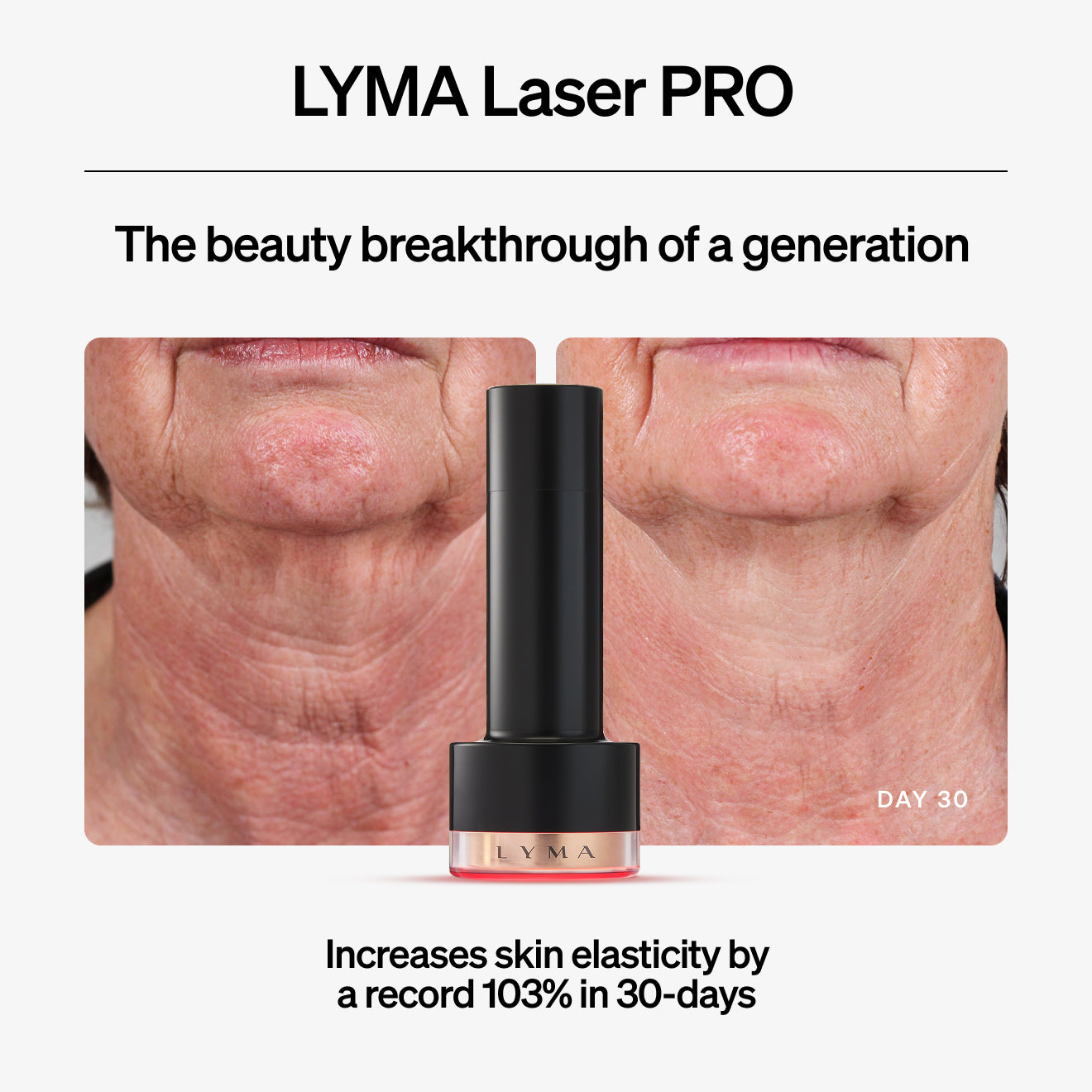 Shop The LYMA Laser PRO. Pay in up to 12 Instalments. Free Shipping