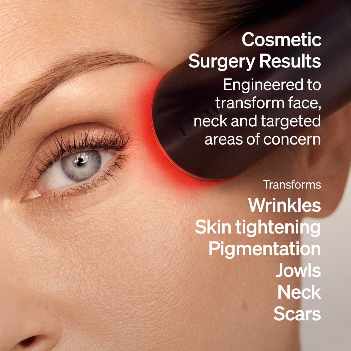 Shop the LYMA Laser – The World’s Most Powerful At-Home Skincare Laser