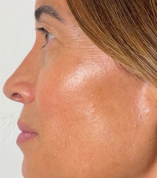 LYMA. Powerful Like you. World-Leading Anti-Ageing Skin Lasers