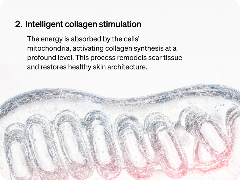 The LYMA Laser: Advanced Scar Treatment for Flawless Skin