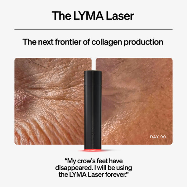 Shop The LYMA Laser: Pay in up to 12 Instalments. Free Express Shipping.