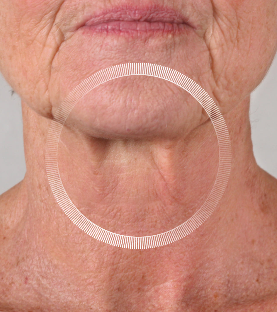 LYMA. Powerful. Like you. World-Leading Anti-Ageing Innovations