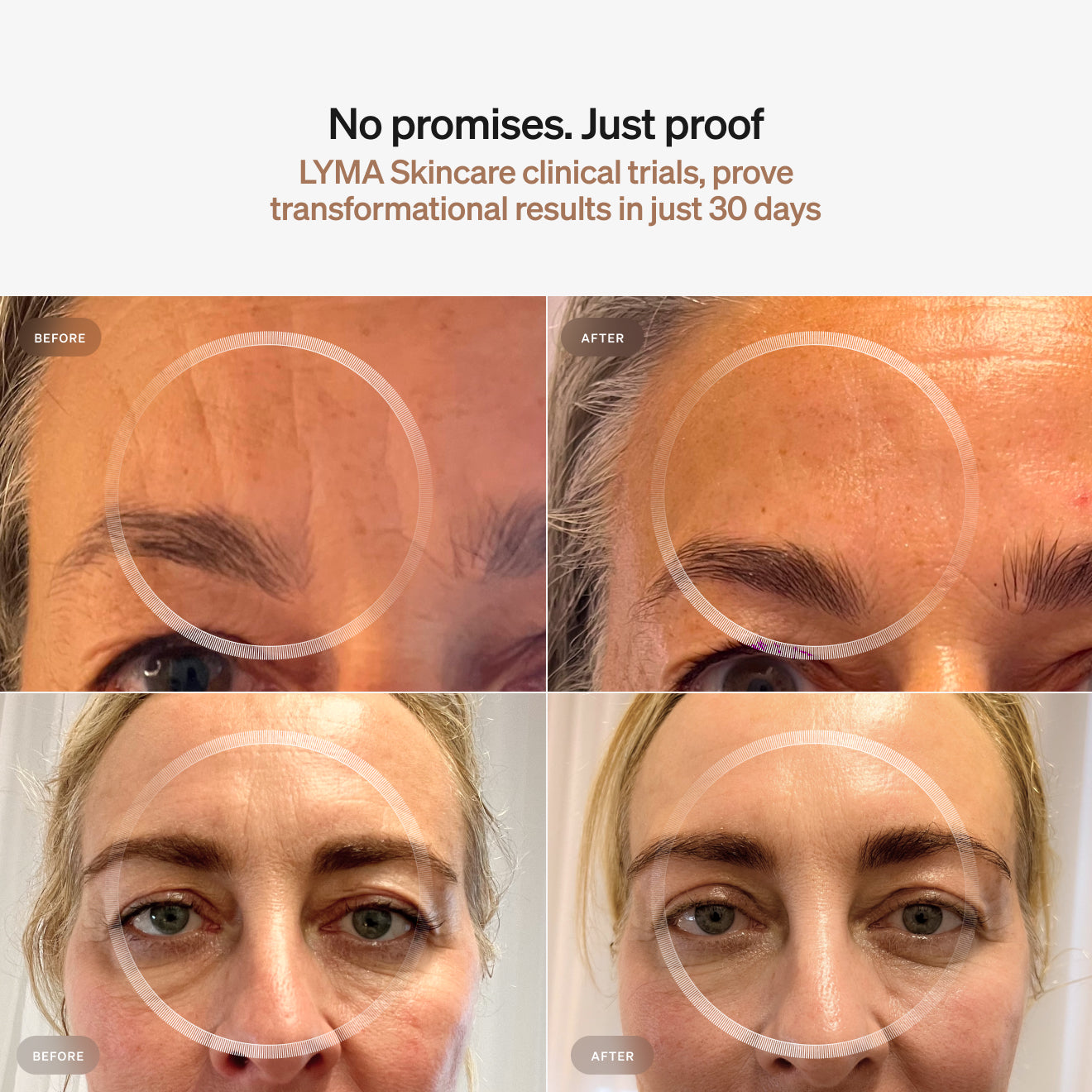 Shop LYMA Skincare Starter Kit: Your Journey to Radiant Skin